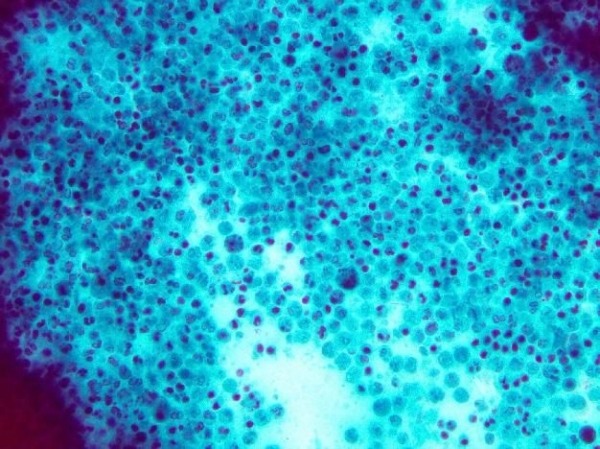 Traditional Stool Tests | Genesis Labs