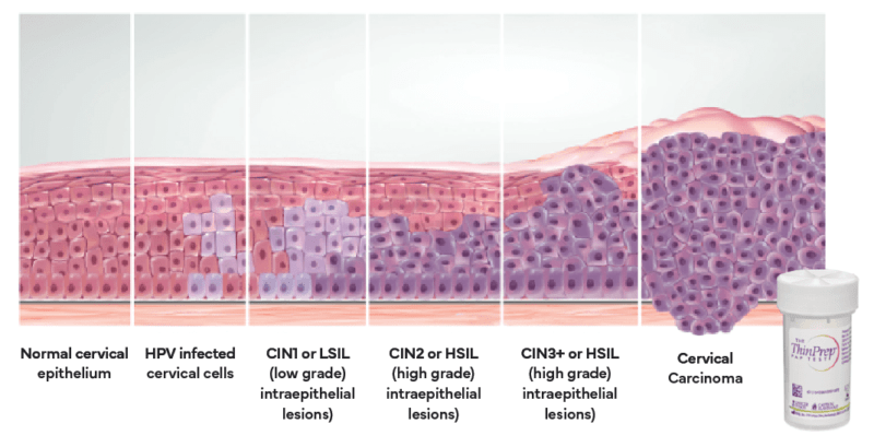 Anorectal Pathology with Molecular Testing | Genesis Labs